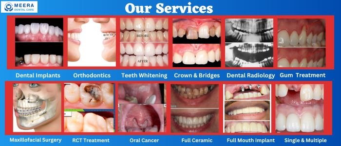 No1 Orthodontist Dental Clinic Ajmer By Dr. Tarun Gaur
