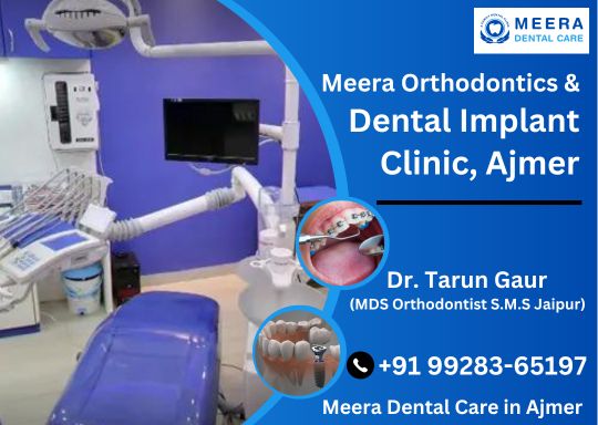 No1 Orthodontist Dental Clinic Ajmer By Dr. Tarun Gaur